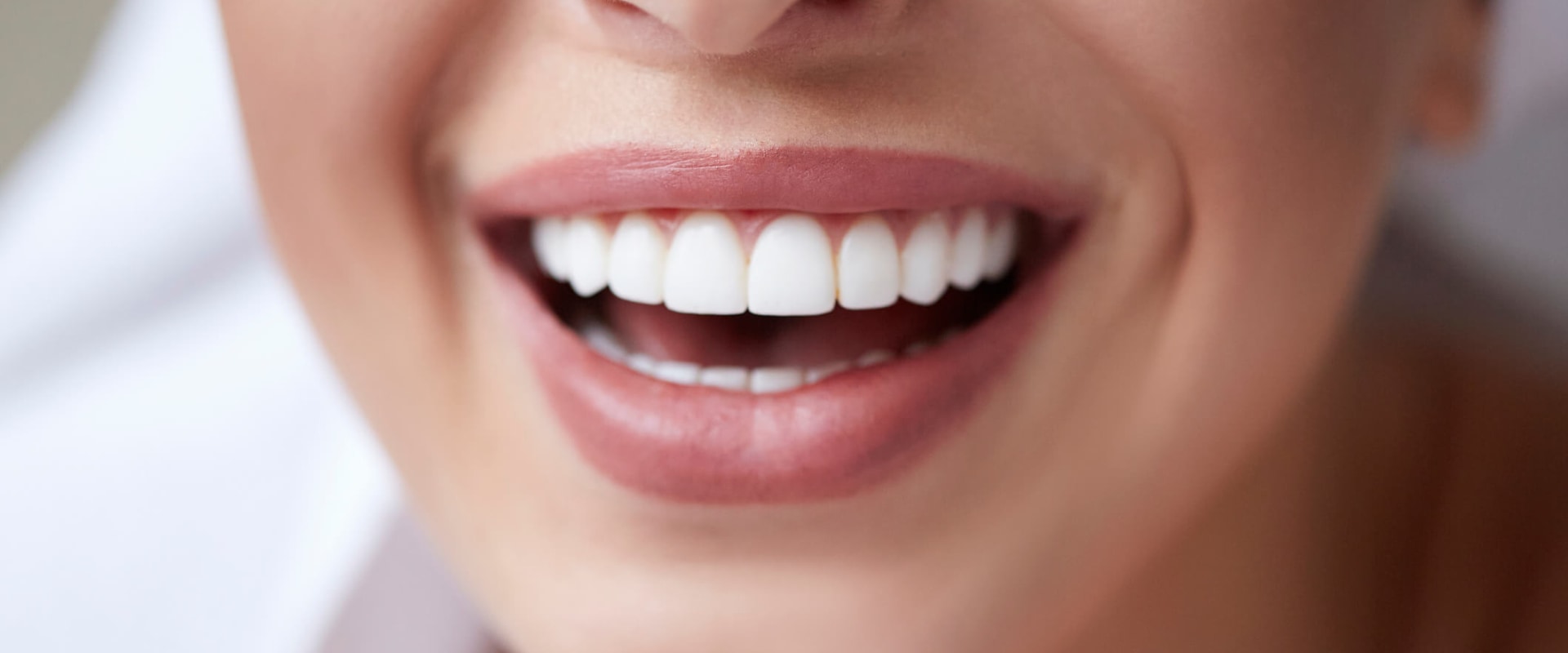 Can You Get Veneers on Top Teeth Only?